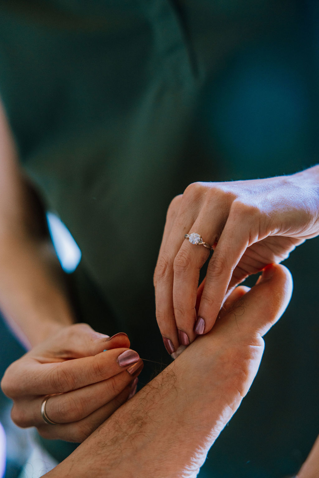 What is acupuncture? | FAQ's | Peaceful Owl Acupuncture